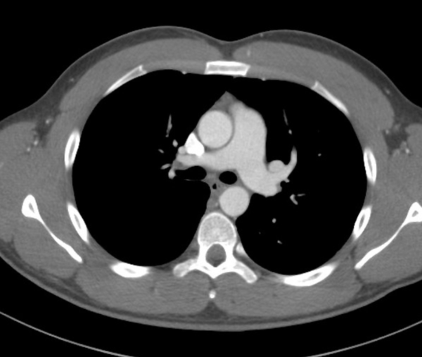 Mastering Test-Taking Strategies: Your Key to Passing the CT ARRT ...